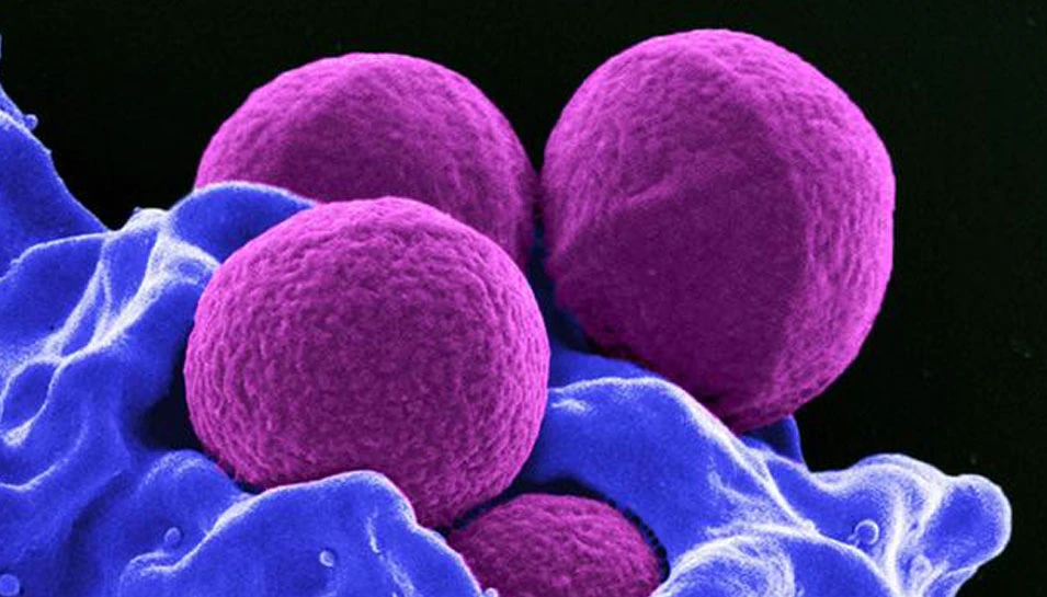 รู้นะว่า superbug คืออะไร ทำไมถึงฆ่าคนเป็นล้าน | Superbug: Superbug ...